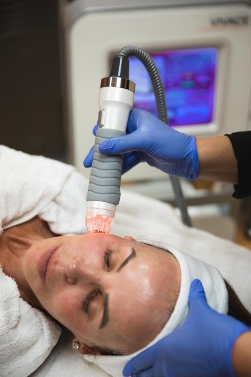 RF Microneedling in Denver | Aria Integrative Health